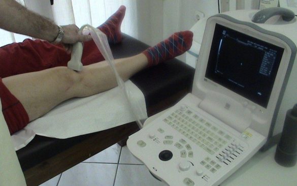 What is Diathermy and its Benefits - Health Care Reform