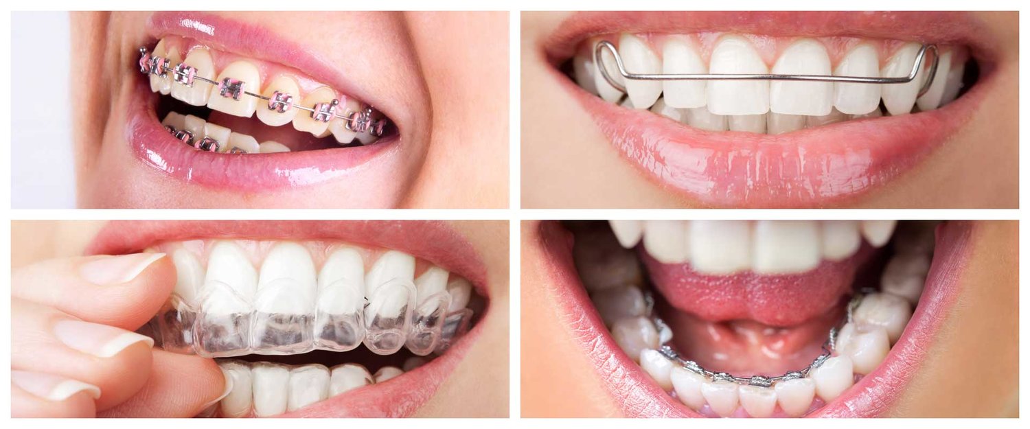 Adult Orthodontics: Understanding Your Options - Health Care Reform