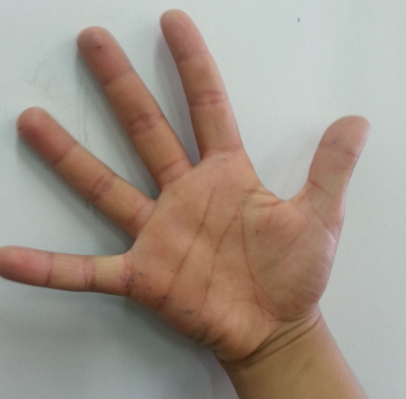 Weird Surgical Procedures Doctors Carried out - Health Care Reform