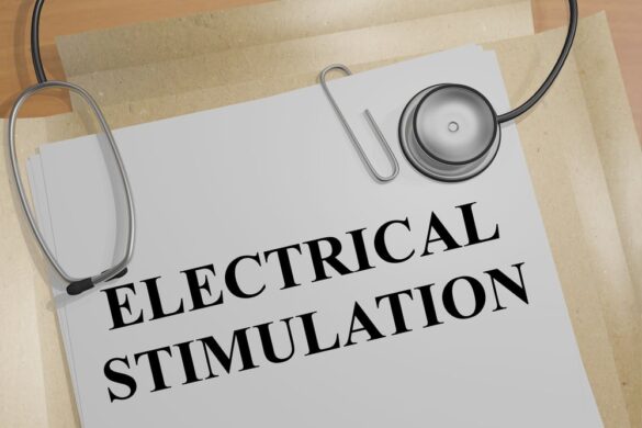 Can You Treat Urinary Incontinence With Electrical Stimulation - Health ...