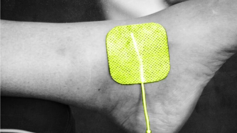 Can You Treat Urinary Incontinence With Electrical Stimulation - Health ...